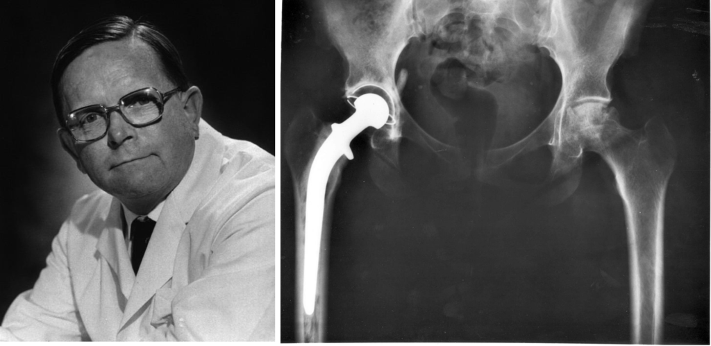 State of Implant Research - BioTrib